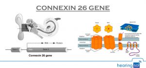 Connexin 26 Gene Linked To Sensorineural Hearing Loss