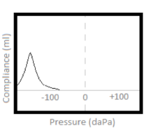 Tympanometry A Middle Ear Test | Purpose, Risks & Procedure