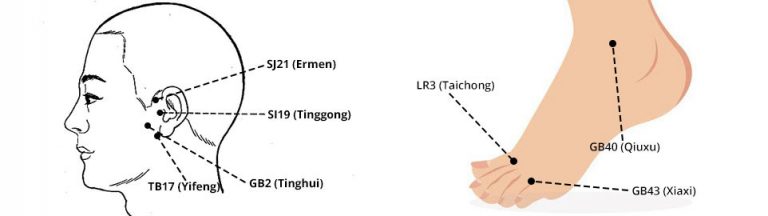 Acupressure & Acupuncture Therapy Points For Hearing Loss
