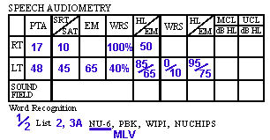 What Are The Features Of A Modern Hearing Test? - Hearing Sol