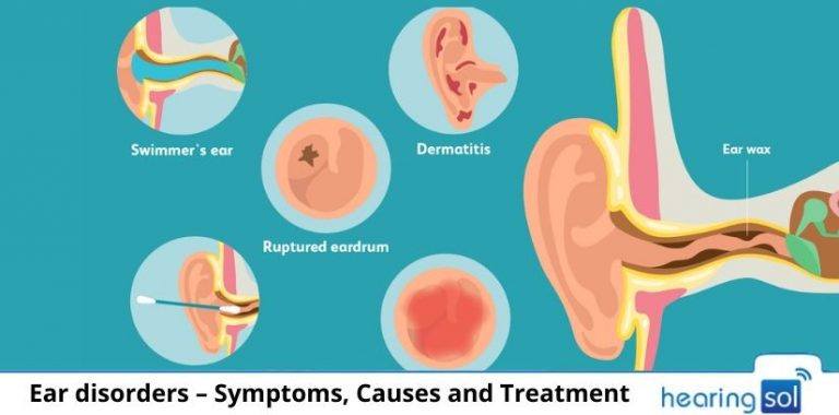 Common Ear Disorders - Causes, Symptoms And Best Treatment