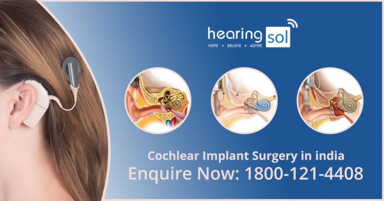 Best Cochlear Implant Surgery Center In Delhi | HearingSol Best Cochlear Implant Surgery Center In Delhi | HearingSol