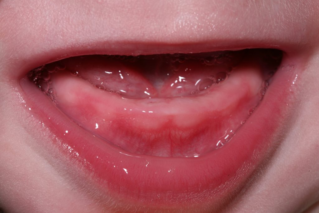 Baby Teething Signs, Timeline and Best Pain Relieving Tips Baby Teething Signs, Timeline and Best Pain Relieving Tips
