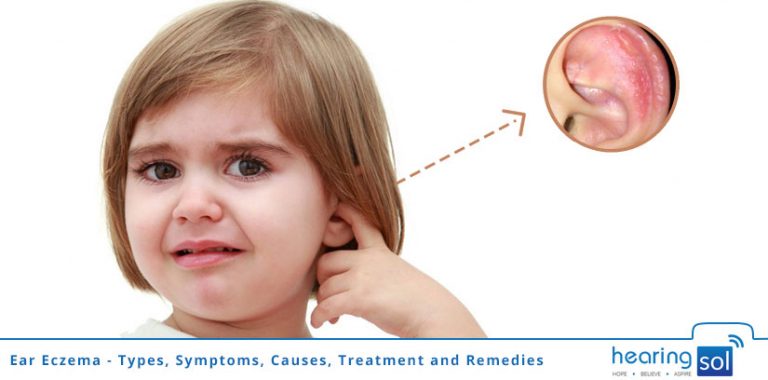 Ear Eczema - Symptoms, Causes, Treatment & Best Remedies